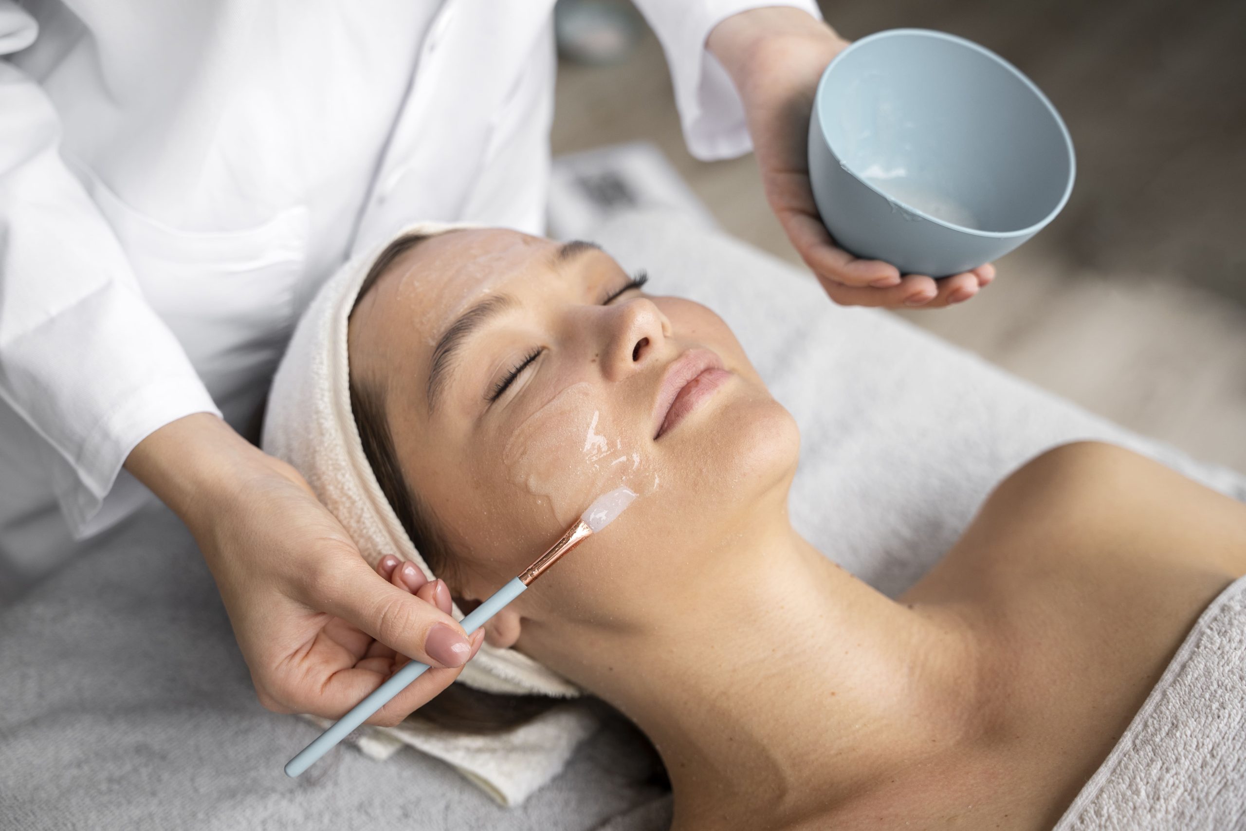 Jerawat Tak Kunjung Hilang? Chemical Peeling Bisa Jadi Solusinya